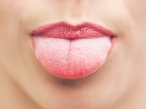What's Wrong With My Tongue? Common Tongue Problems